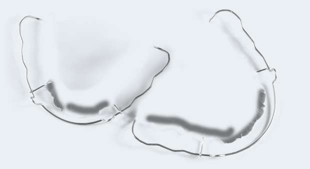 Retainer | Keaton Orthodontics | Pikeville Kentucky